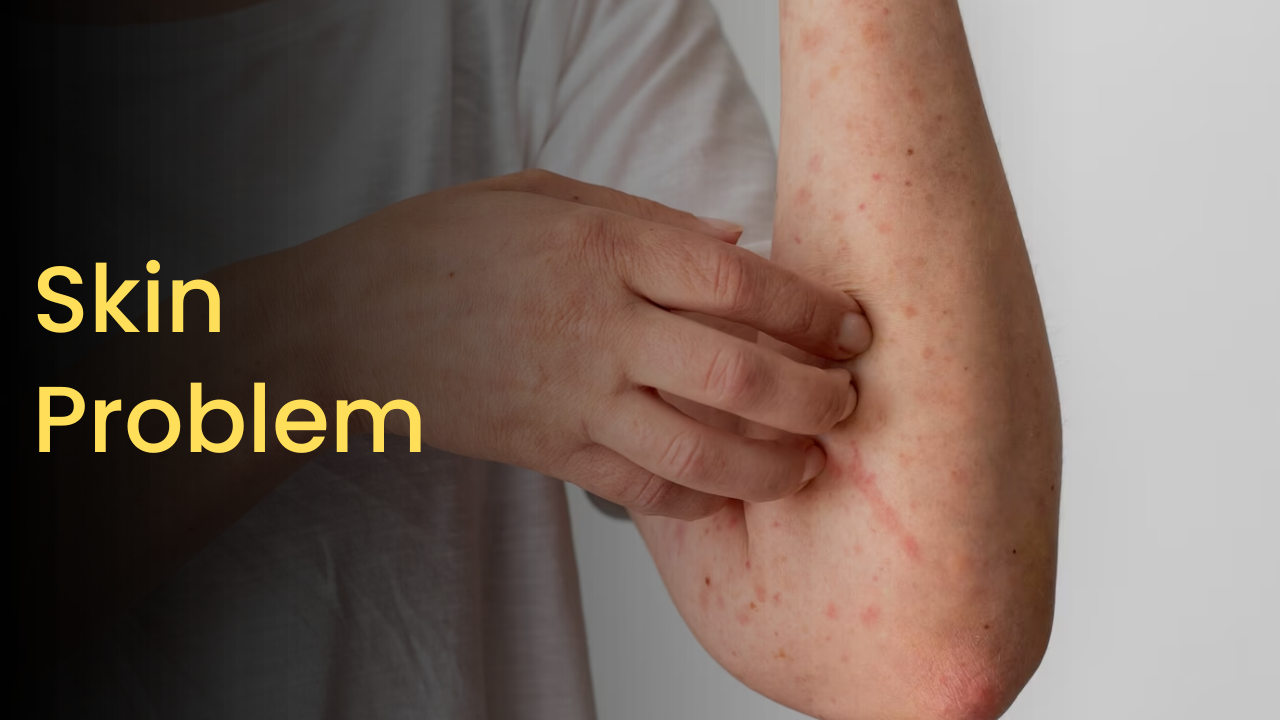 skin-disease - Sandhya Medicity
